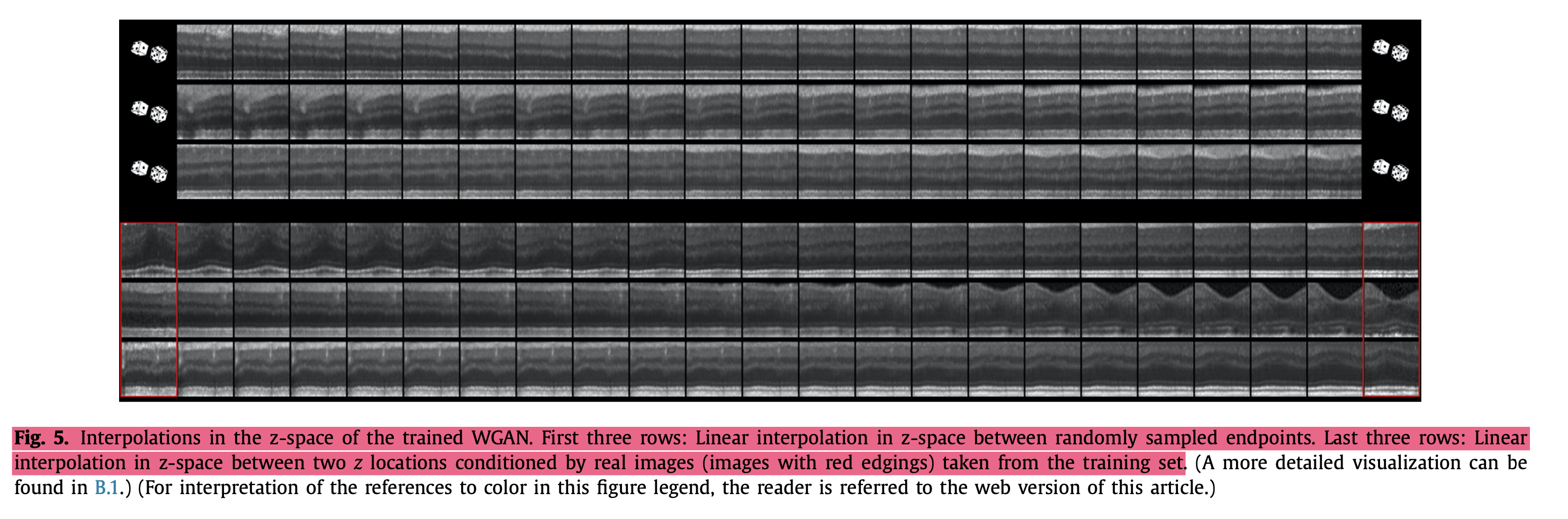 Deep learning paper notes (anomaly detection)-f-AnoGAN: Fast ...