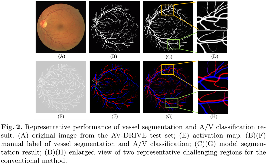 眼底血管分割MICCAI 2019论文详解Multi-task Neural Networks with Spatial Activation for Retinal Vessel..._动 ...