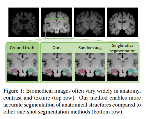 2019计算机视觉方向调研_densefusion 抗环境光照变化-CSDN博客