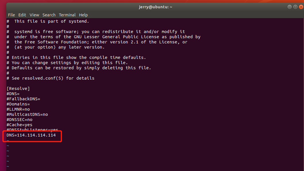 Ubuntu18.04虚拟机桥接模式连wifi并配置静态IP_虚拟机ubuntu18.04 设置wifi-CSDN博客