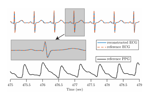 从PPG重建ECG心电图的初步研究_通过ppg怎么得到ecg_Da小伙儿的博客-CSDN博客