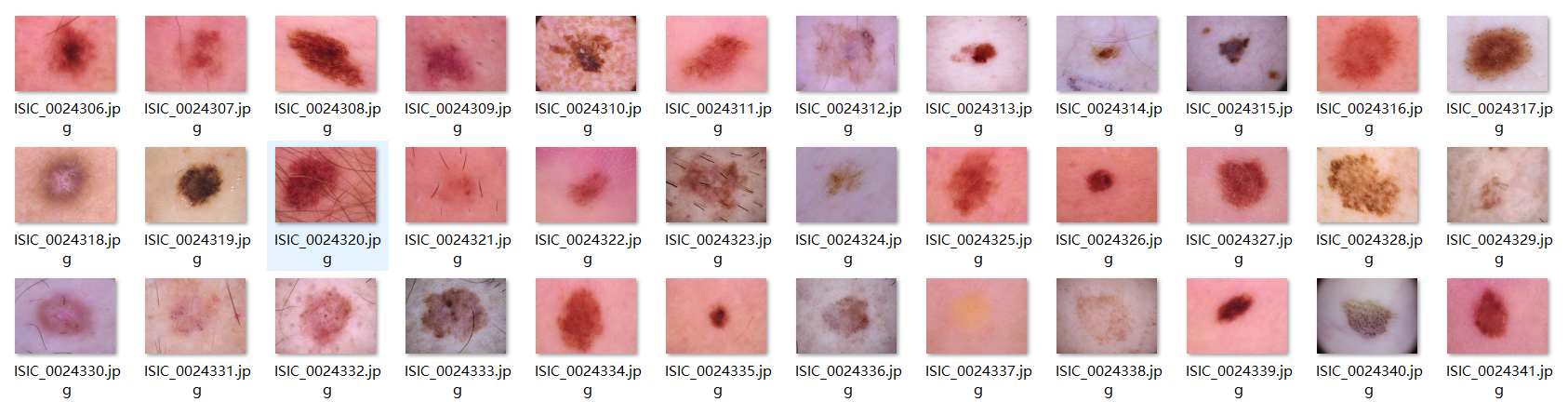 python---ISIC2018预处理---根据类别文件存储位置复制-CSDN博客