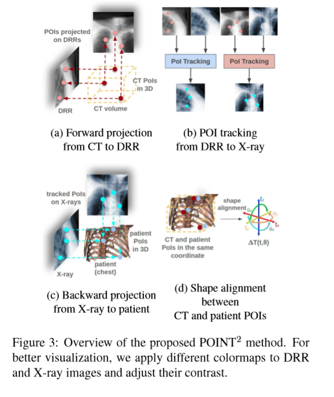 论文笔记：Multiview 2D/3D Rigid Registration_multi view registration-CSDN博客