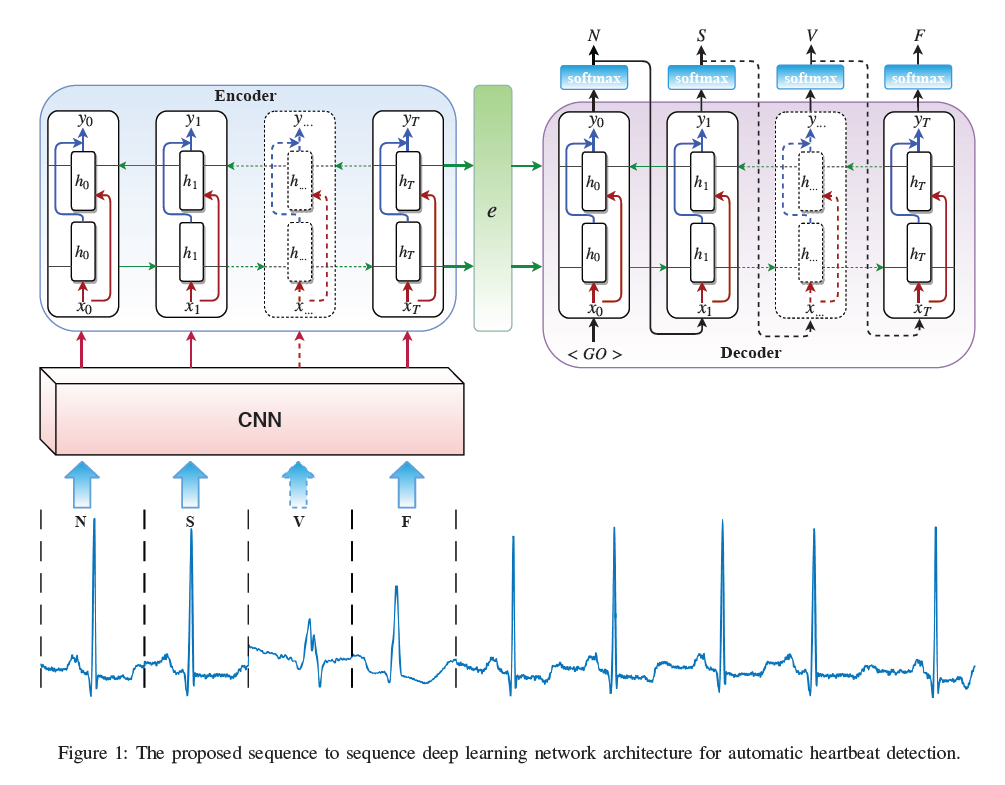 文献笔记——ECG分类器（Inter- and intra- patient ECG heartbeat classification ...
