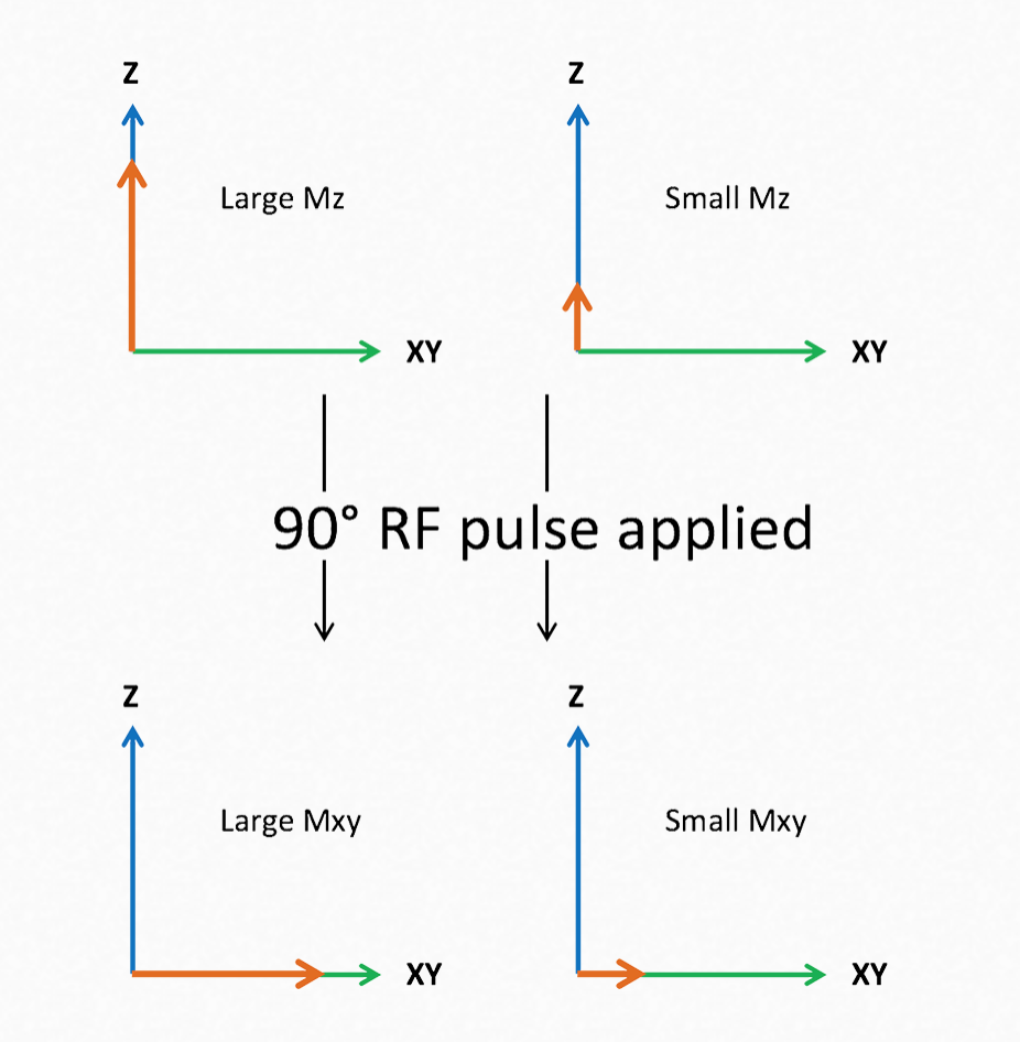 【影像学基本知识】T1, T2 and PD weighted imaging-CSDN博客