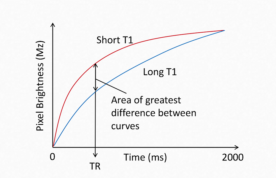 【影像学基本知识】T1, T2 and PD weighted imaging-CSDN博客