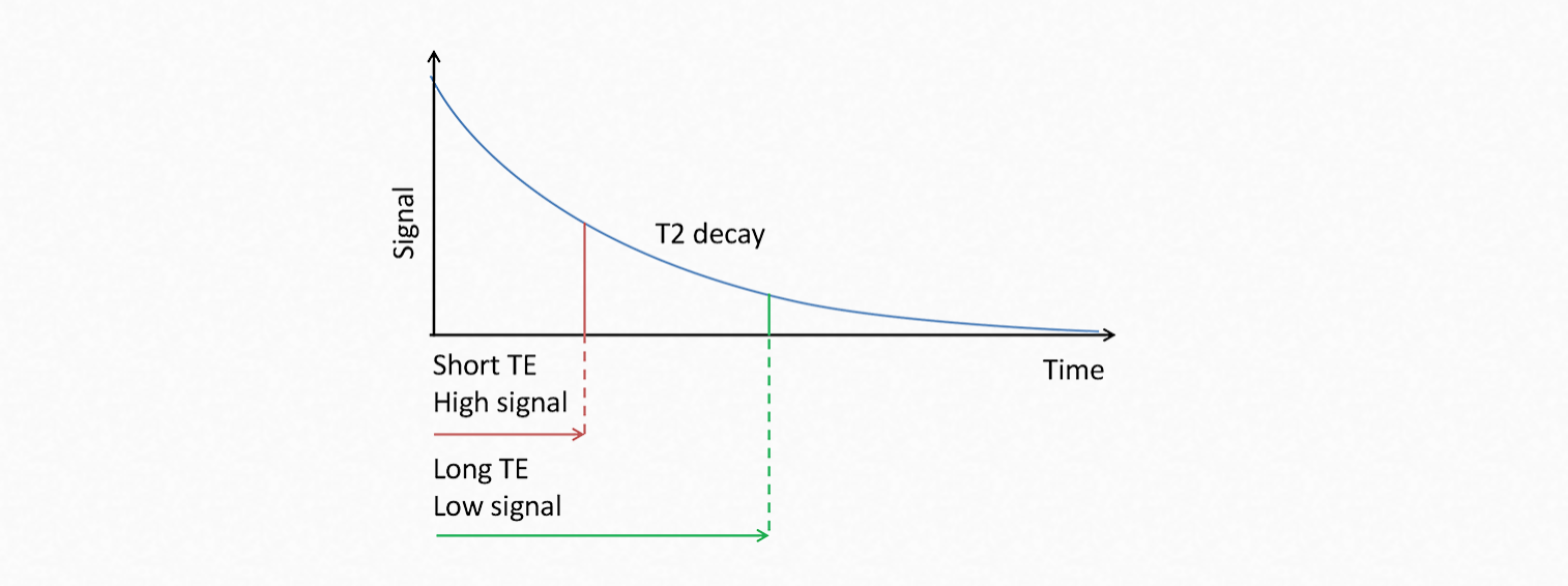 【影像学基本知识】T1, T2 and PD weighted imaging-CSDN博客