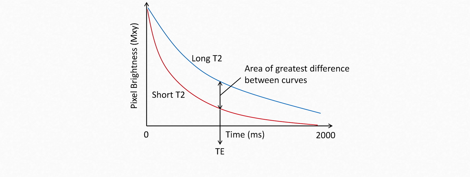 【影像学基本知识】T1, T2 and PD weighted imaging-CSDN博客