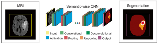 Deep Learning for Brain MRI Segmentation: State of the Art and Future ...