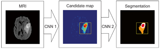 Deep Learning for Brain MRI Segmentation: State of the Art and Future ...