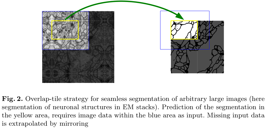 Unet论文详解U-Net:Convolutional Networks for Biomedical Image Segmentation-CSDN博客