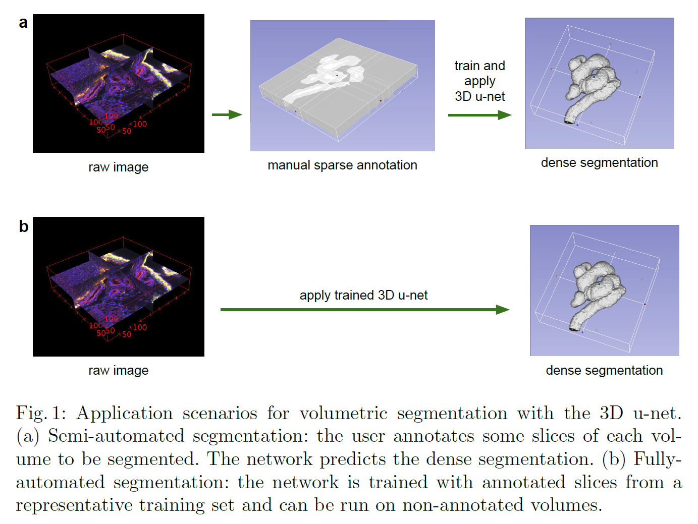 3D U-Net: Learning Dense Volumetric Segmentation from Sparse Annotation-CSDN博客