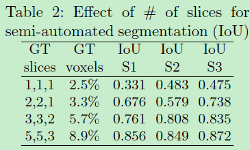 3D U-Net: Learning Dense Volumetric Segmentation from Sparse Annotation-CSDN博客