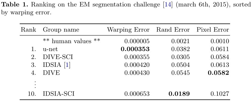Unet论文详解U-Net:Convolutional Networks for Biomedical Image Segmentation-CSDN博客