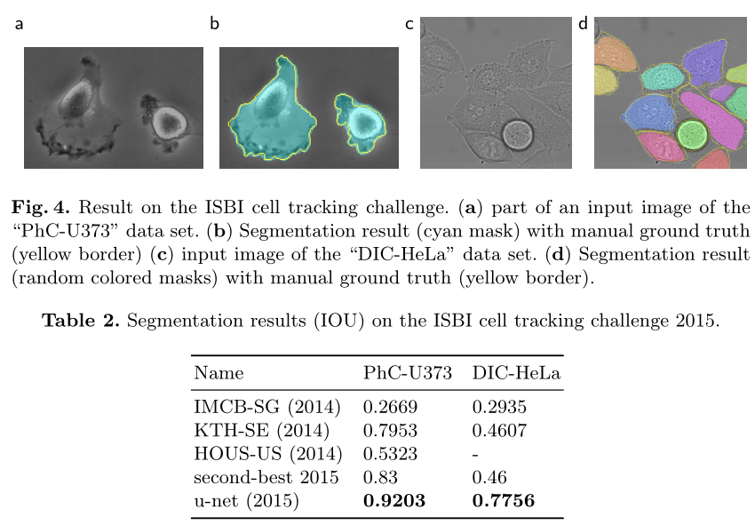 Unet论文详解U-Net:Convolutional Networks for Biomedical Image Segmentation-CSDN博客
