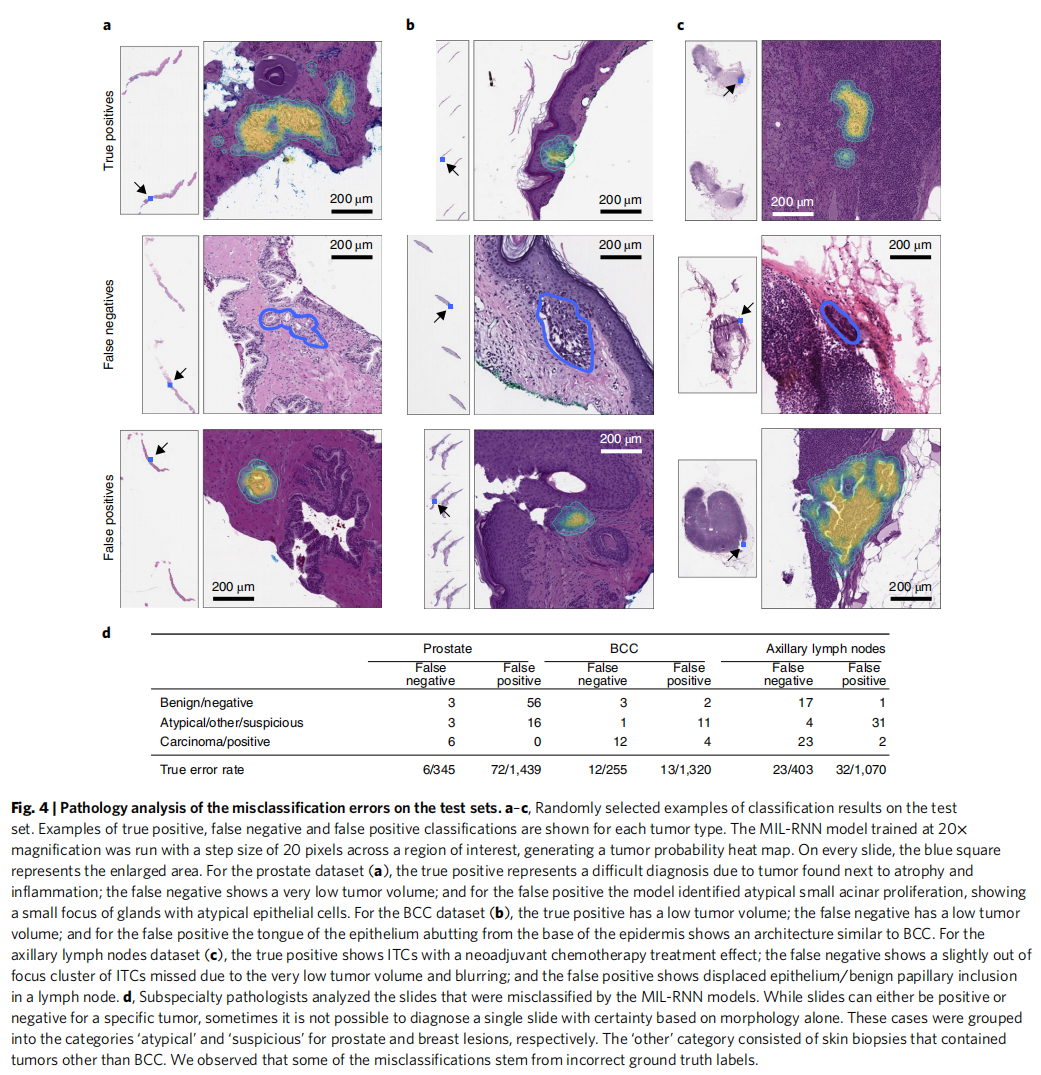 Clinical grade computional pathology using weakly supervised deep ...
