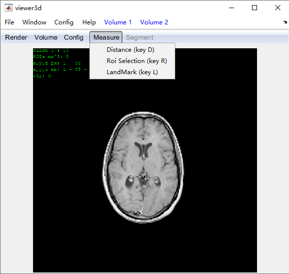 MATLAB医学三维重建可视化库_matlab超声曲面voi设计三维重建-CSDN博客