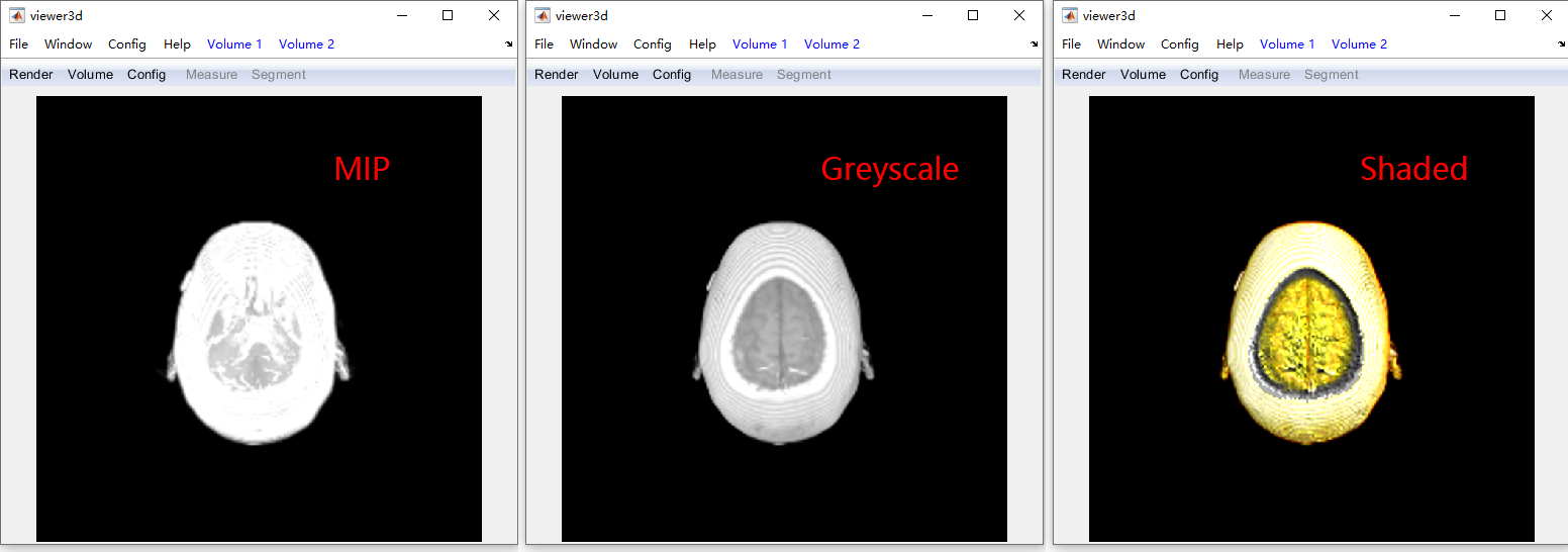 MATLAB医学三维重建可视化库_matlab超声曲面voi设计三维重建-CSDN博客