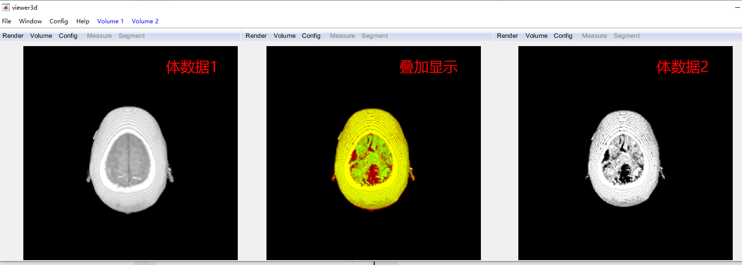 MATLAB医学三维重建可视化库_matlab超声曲面voi设计三维重建-CSDN博客