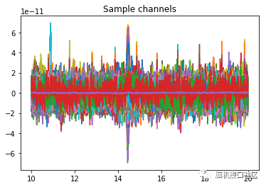 Python-EEG工具库MNE-Python详细安装与使用_pip安装 mne包下载-CSDN博客