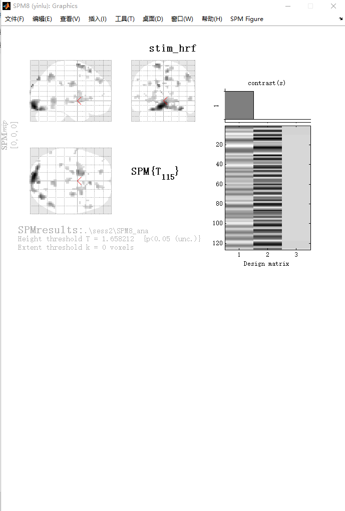 MarsBar教程_marsbar安装包-CSDN博客
