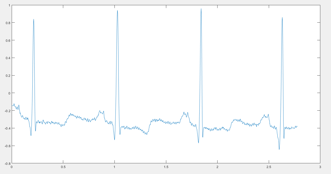 MATLAB的WFDB软件下载及使用_matlab怎么用wfdb包处理.dat-CSDN博客