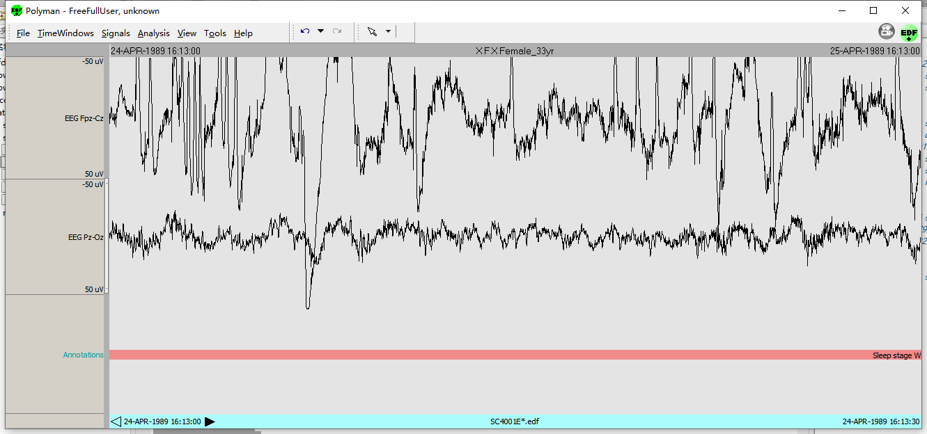 Sleep-EDF Database Expanded 读取_sleepedfx数据集预处理-CSDN博客
