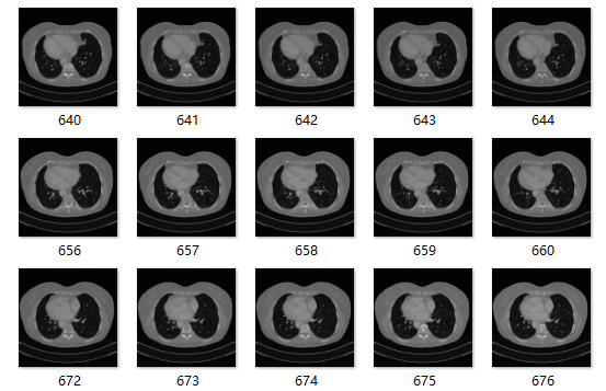 .nii格式文件批量读取保存为.png格式Python实现_nibabel.load()读取的数据保存为.png文件-CSDN博客