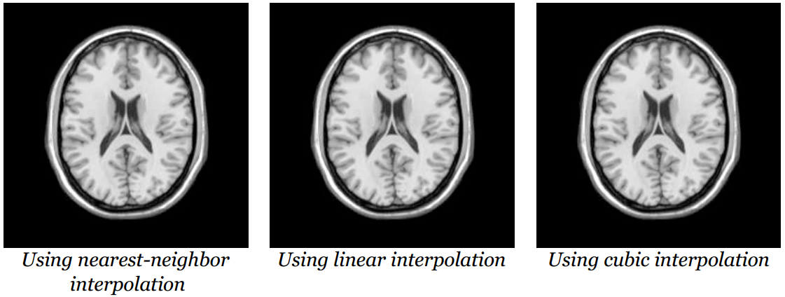 learn2reg-配准介绍_learn2reg介绍-CSDN博客