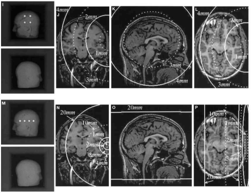 learn2reg-配准介绍_learn2reg介绍-CSDN博客