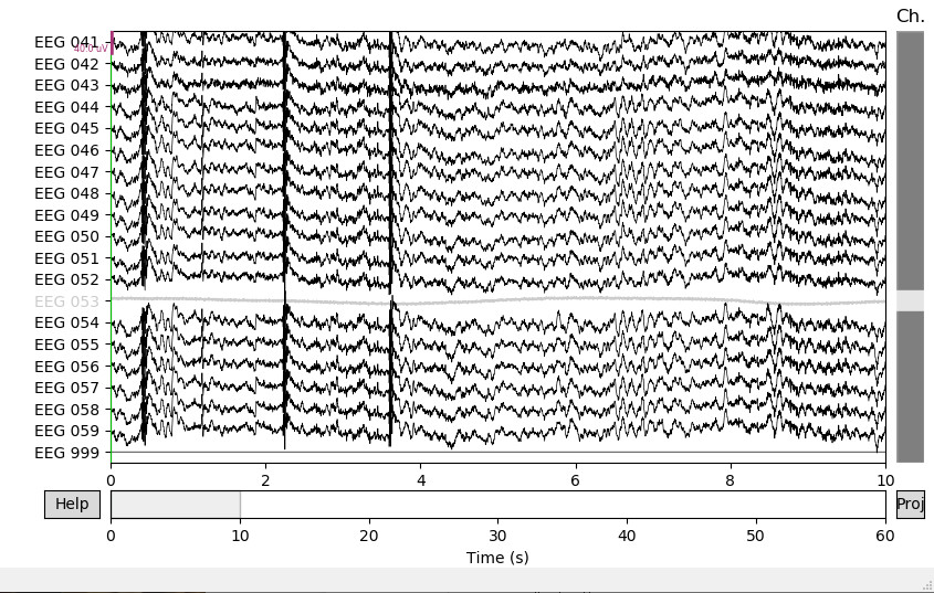 Python-EEG工具库MNE中文教程(8)-参考电极简介_mne添加参考电极-CSDN博客