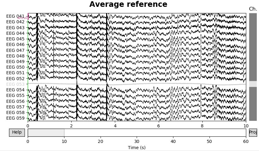 Python-EEG工具库MNE中文教程(8)-参考电极简介_mne添加参考电极-CSDN博客