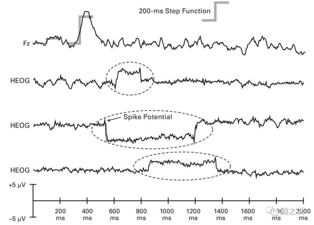 全面总结EEG信号中常见的干扰和噪声信号 - 我爱神经科学网-脑科学-脑电EEG-事件相关电位ERP-磁共振MRI-fMRI-DTI-机器学习 ...