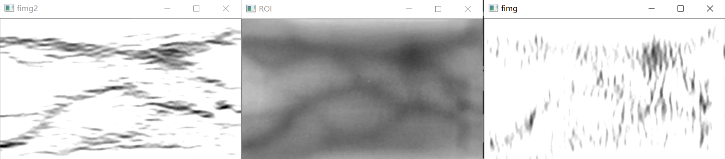 opencv-python 用Gabor滤波器实现指静脉血管区域二值化纹理特征提取_lustyoung的博客-CSDN博客