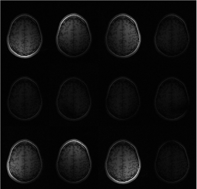 利用MTALAB显示磁共振图像（多线圈）_matlab输出mri图像-CSDN博客