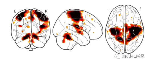 Nilearn教程系列(4)-脑部地图集绘制_harvard oxford atlas 112个roi包括多少个皮质下-CSDN博客