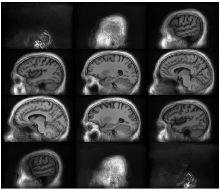 【医疗影像处理】antspy数据读取与保存_ants库将读取的数据转为numpy-CSDN博客