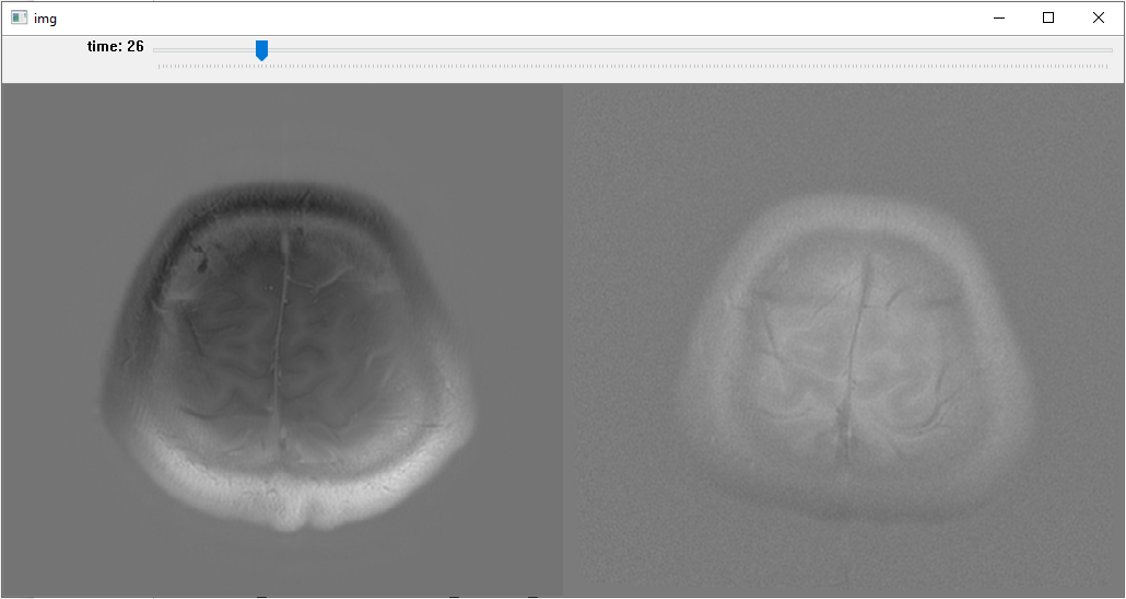opencv & plt可视化显示nii中的slice_opencv能读nii-CSDN博客