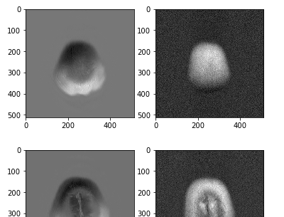 opencv & plt可视化显示nii中的slice_opencv能读nii-CSDN博客