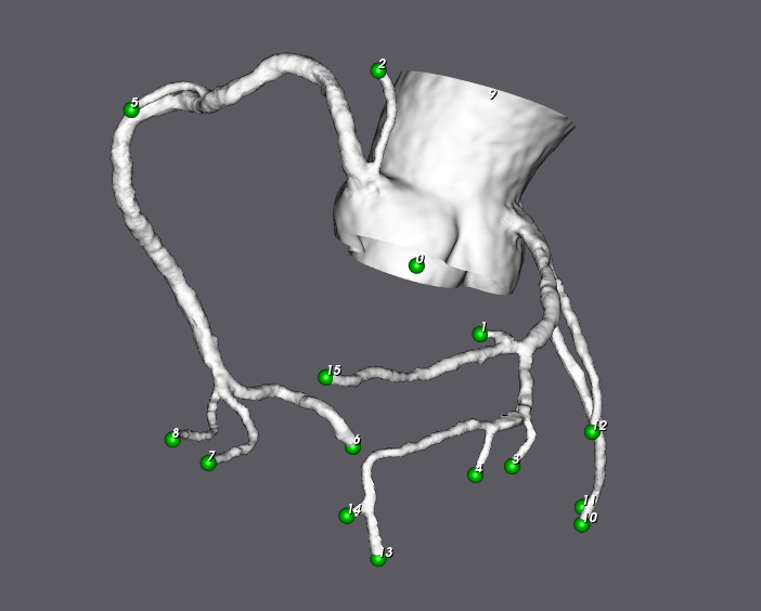 Study-VTK：计算图形中心线（利用vmtk）-CSDN博客