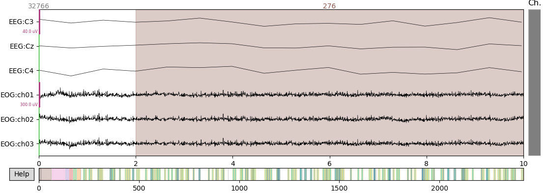 Python 中 MNE 读取EEG竞赛数据绘图和提取epoch（gdf格式）_eeg特征提取python-CSDN博客
