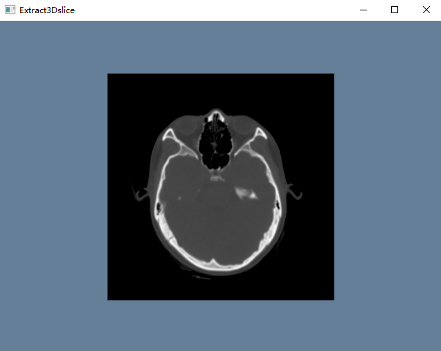 VTK_Learning_三维图像切片（二）———鼠标交互（回调函数、观察者-命令模式）_vtk vtkreslicecursorwidget-CSDN博客