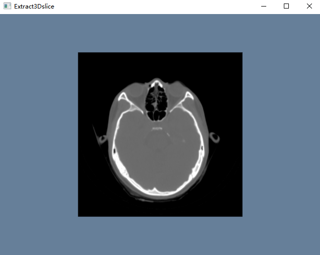 VTK_Learning_三维图像切片（二）———鼠标交互（回调函数、观察者-命令模式）_vtk vtkreslicecursorwidget-CSDN博客