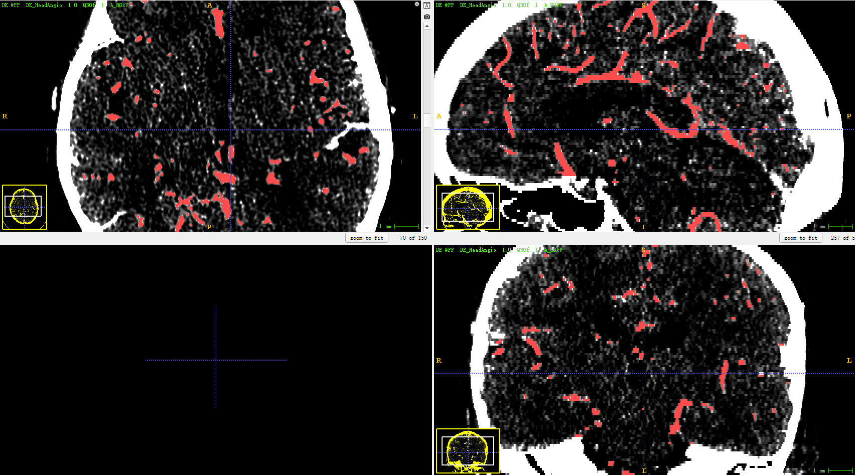 Dicom 医学图像与 Nii 标签数据处理nii数据 Csdn博客