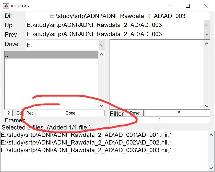 win10 matlab2018a下spm12 + cat安装与使用 - 小白级_cat12安装-CSDN博客
