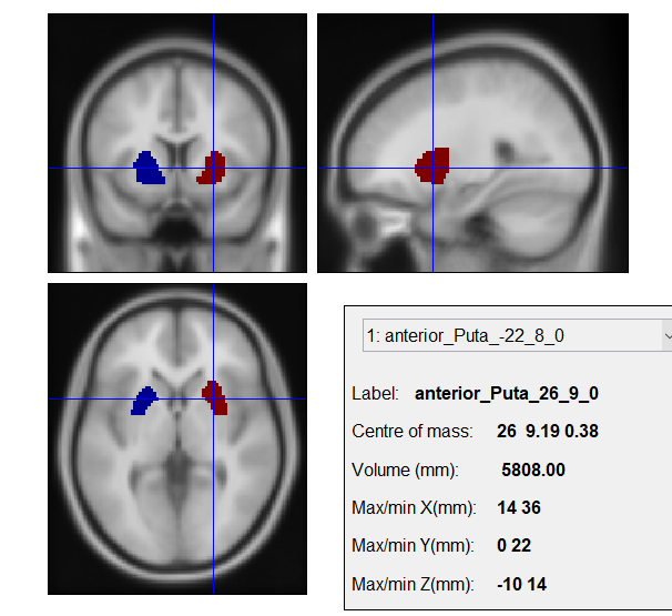 nii格式和mat格式转化（只针对功能磁共振成像）_nii文件转mat文件-CSDN博客