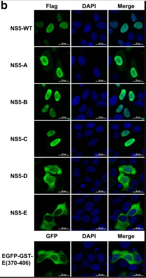 Paper intensive reading (十一)：Nuclear localization of Zika virus NS5 ...