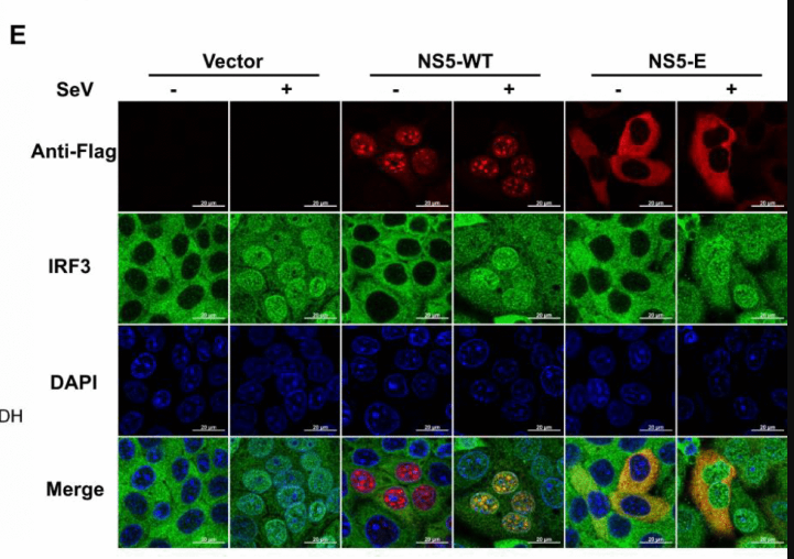 Paper intensive reading (十一)：Nuclear localization of Zika virus NS5 ...