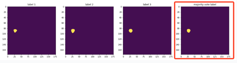 【SimpleITK】分割结果融合策略_分割结果重合-CSDN博客