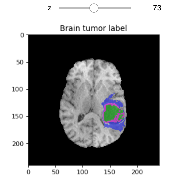 【SimpleITK】分割label覆盖到原图上显示_sitk.labeloverlay-CSDN博客